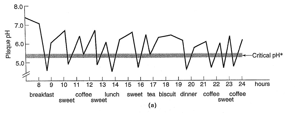 UNDERSTANDING AND PREVENTING DENTAL DECAY - Dr. Loomis General Dentistry