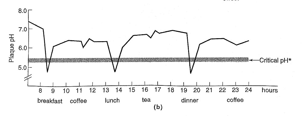 UNDERSTANDING AND PREVENTING DENTAL DECAY - Dr. Loomis General Dentistry